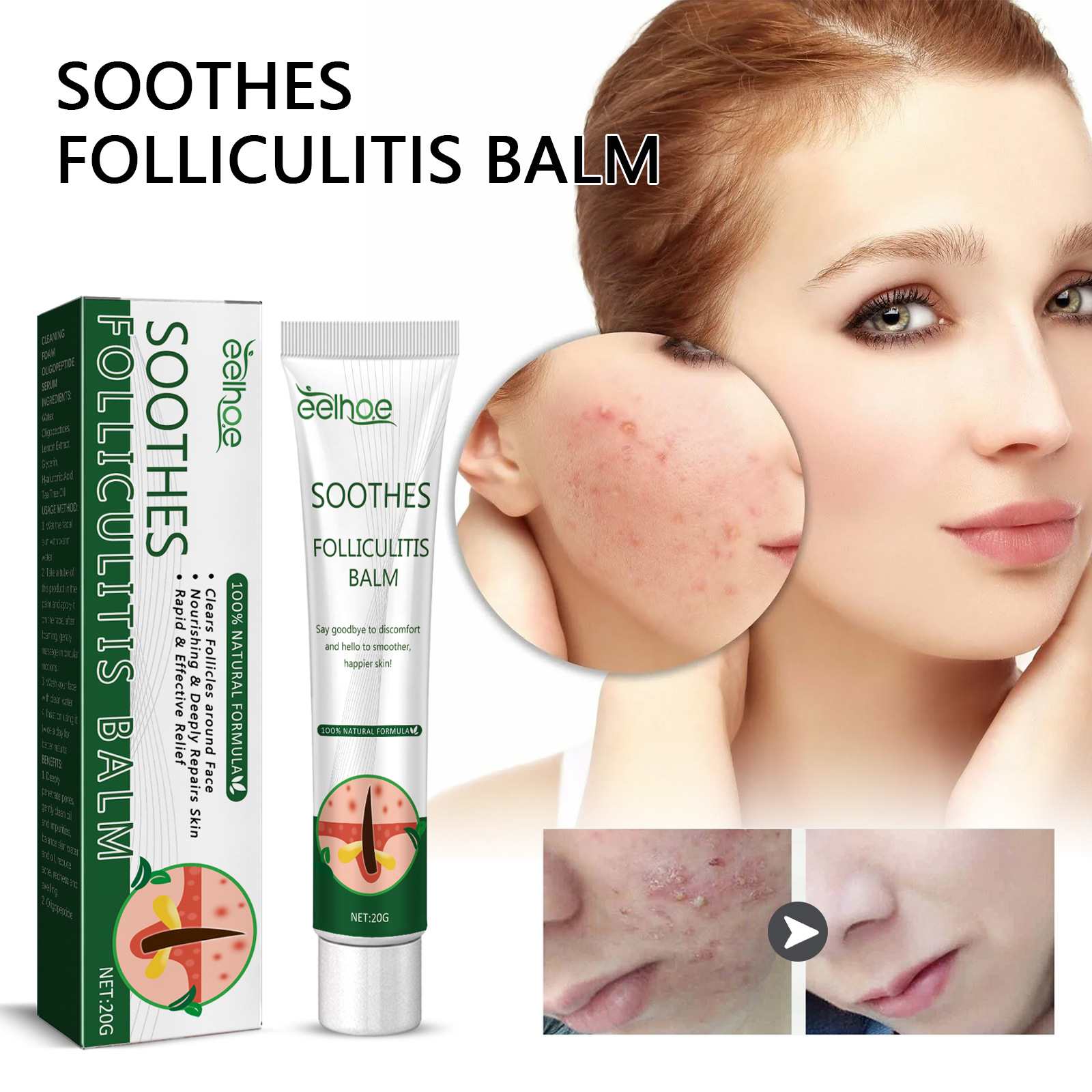 Hair Follicle Repairing Cream Moisturizing And Relieving Skin Itching ...